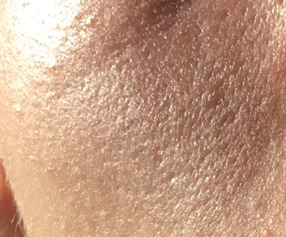 Gesichtshaut extremuneben? (Haut, Gesundheit, Medikamente)