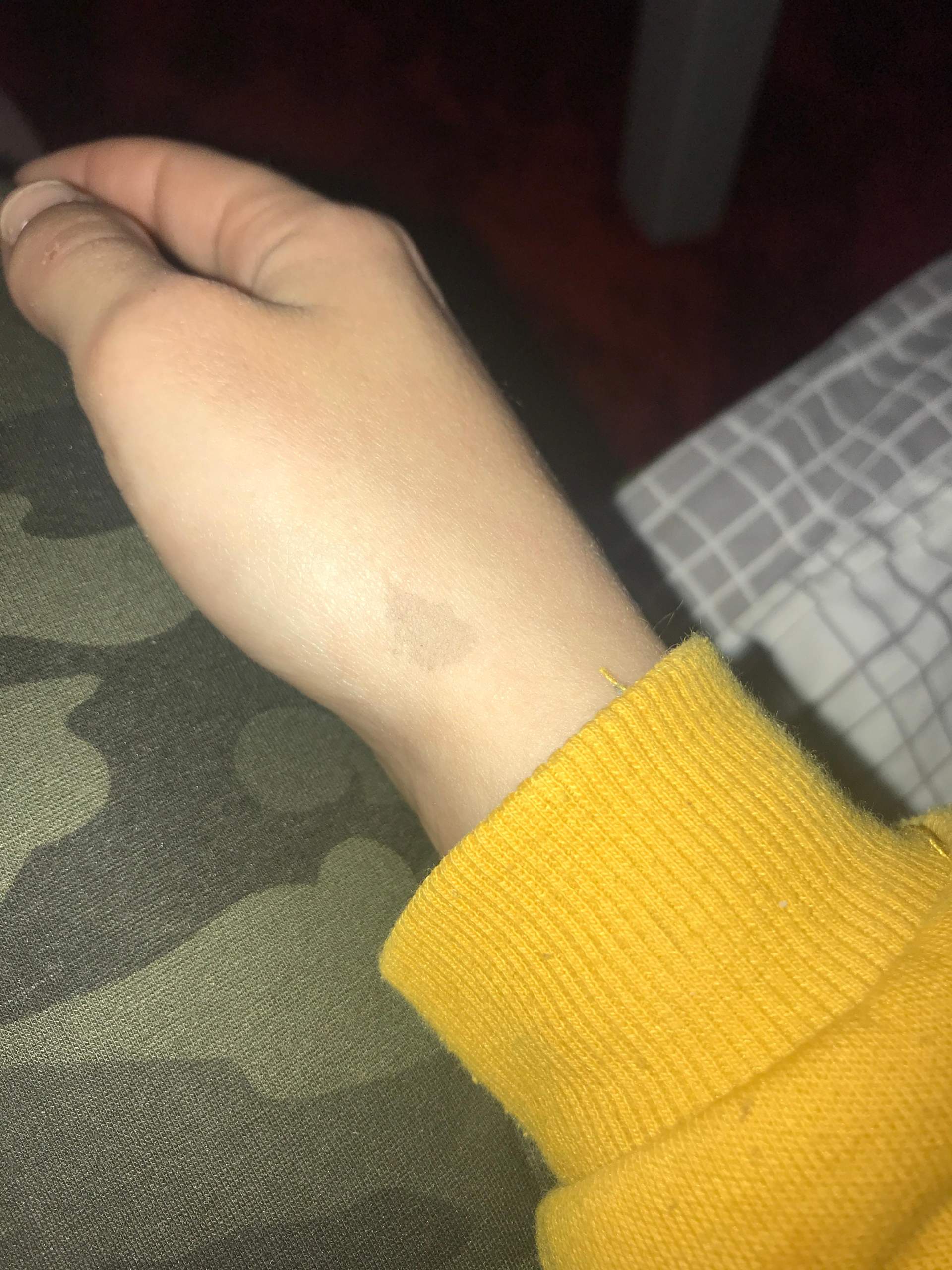 Grauer Fleck an der rechten Hand? (Haut, Flecken)