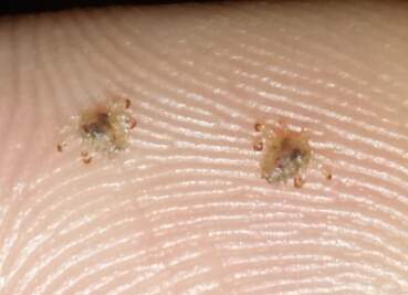 Rätselhafte Insekten/Parasiten?! (Foto!)